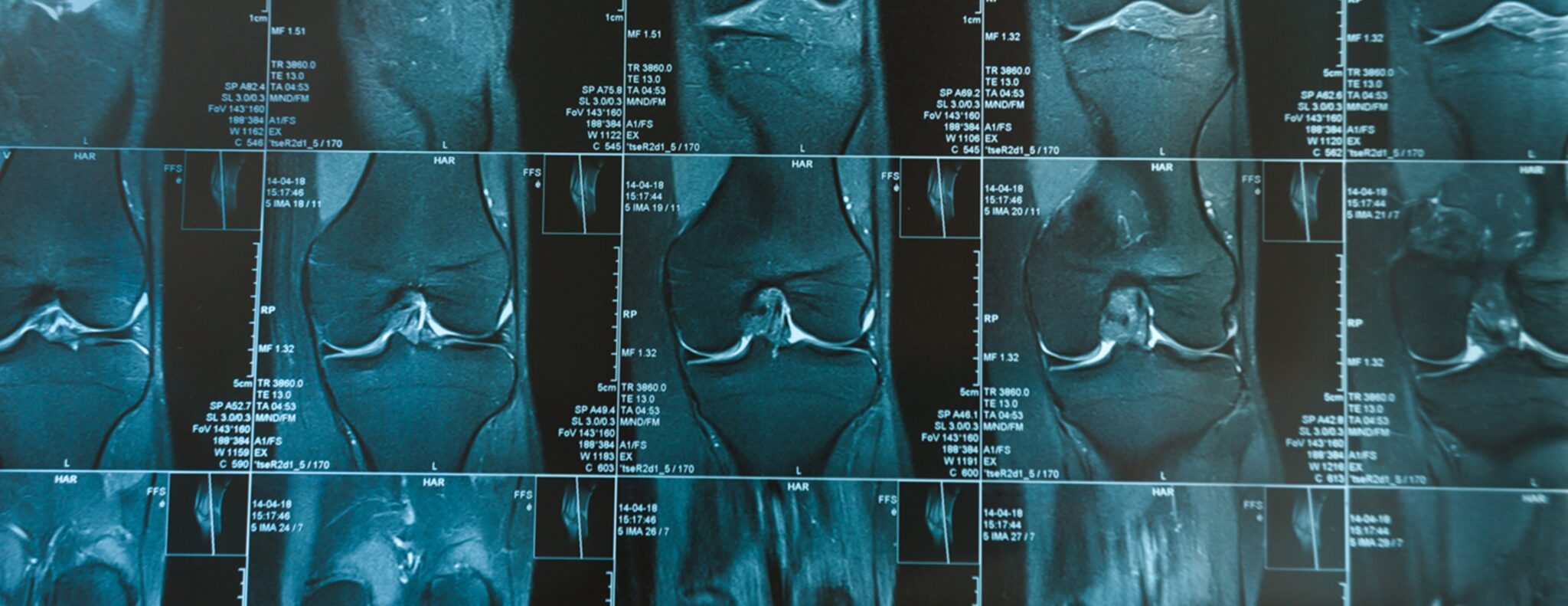 Does Your Whole Body Go In for a Knee MRI? Answered - Scanny